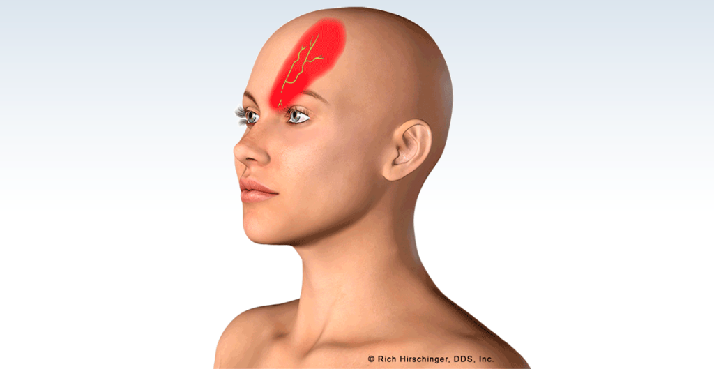 Supratrochlear Supraorbital Infraorbital and Auriculotemporal ...